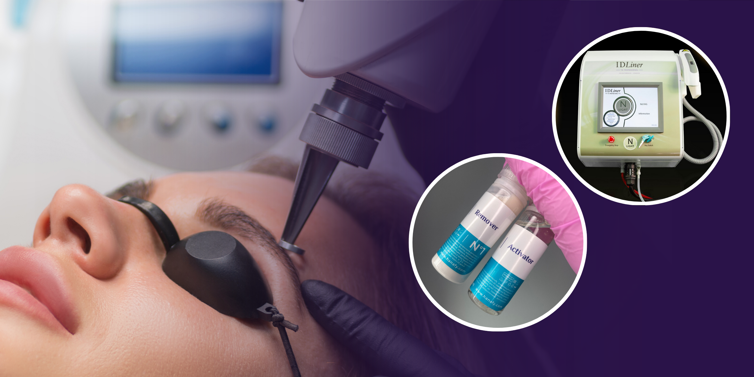 PMU Removal 101: Laser & Manual Removal – ID Liner Pro PMU